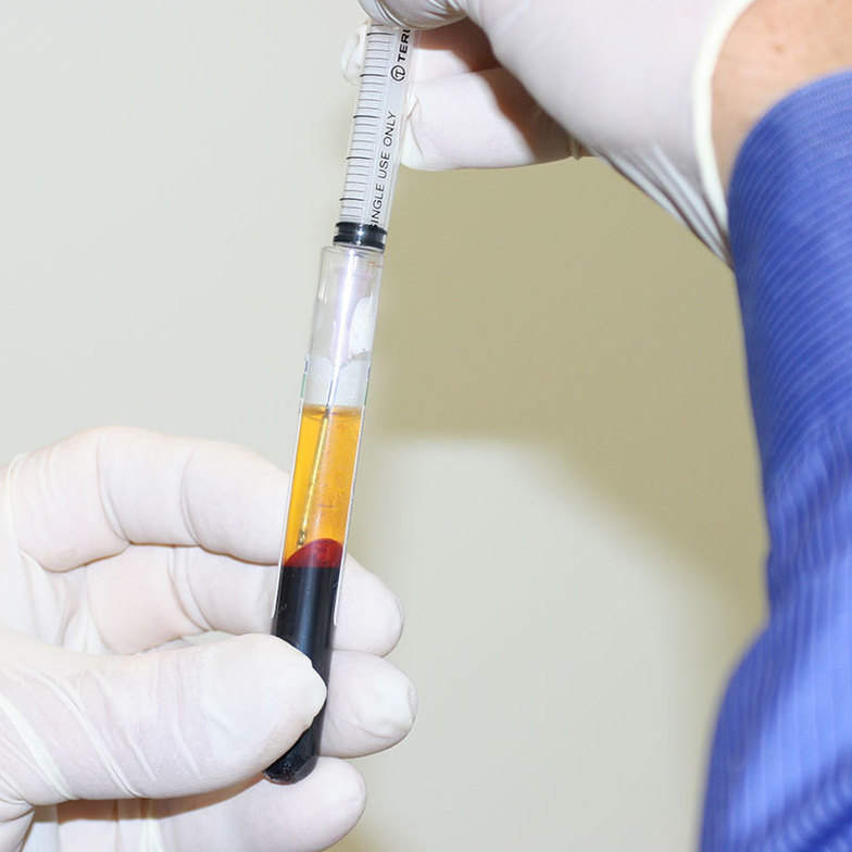 How PRP Injections Work: Simple Guide to Platelet-Rich Plasma Therapy